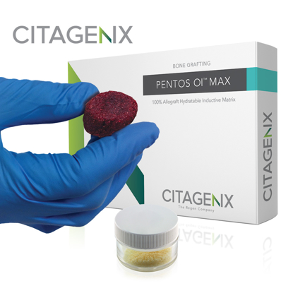 Citagenix Regen LLC. Allografts
