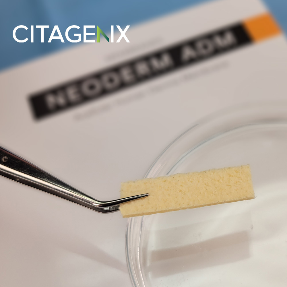 Citagenix Regen LLC. Neoderm™ ADM