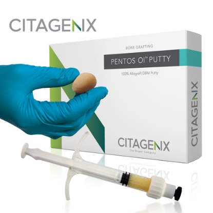 HANSAmed Limited. Allografts