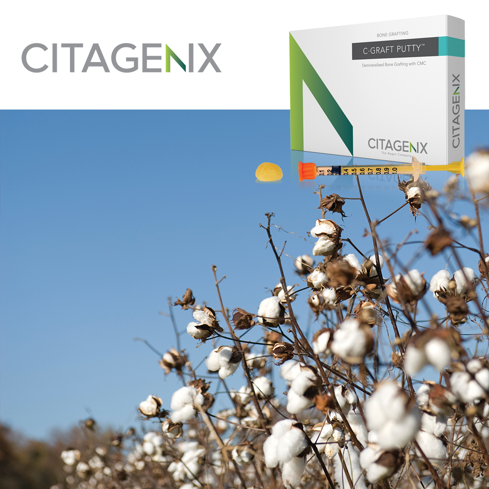 HANSAmed Limited. C-Graft Putty™